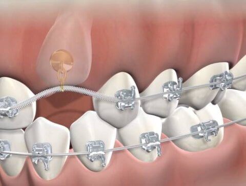 Services - Warren Orthodontics